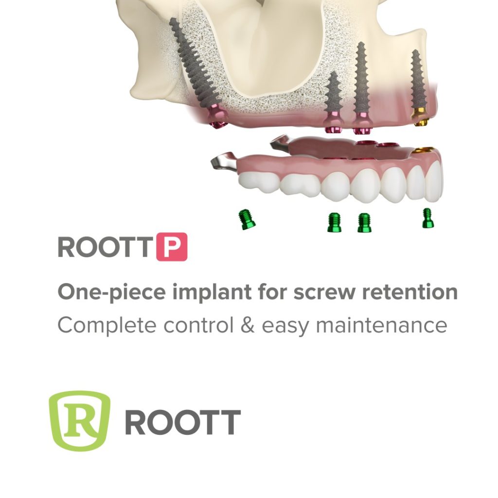 News, Articles, Case Studies | TRATE Dental Implants