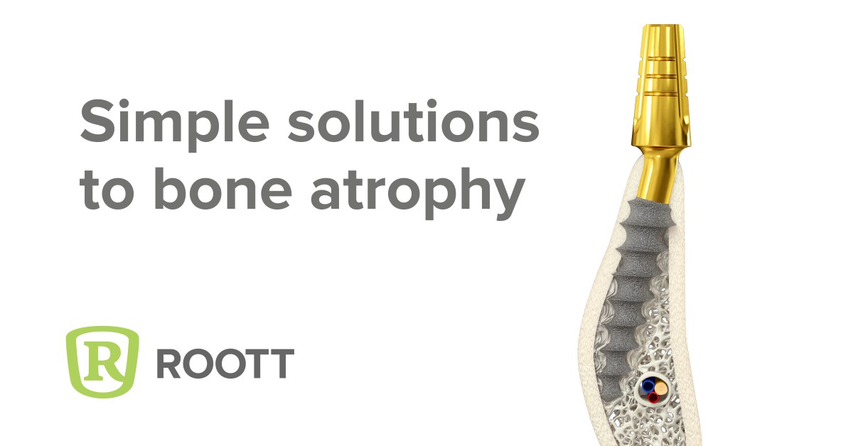 Simplifying the Treatment of Bone Atrophy | TRATE