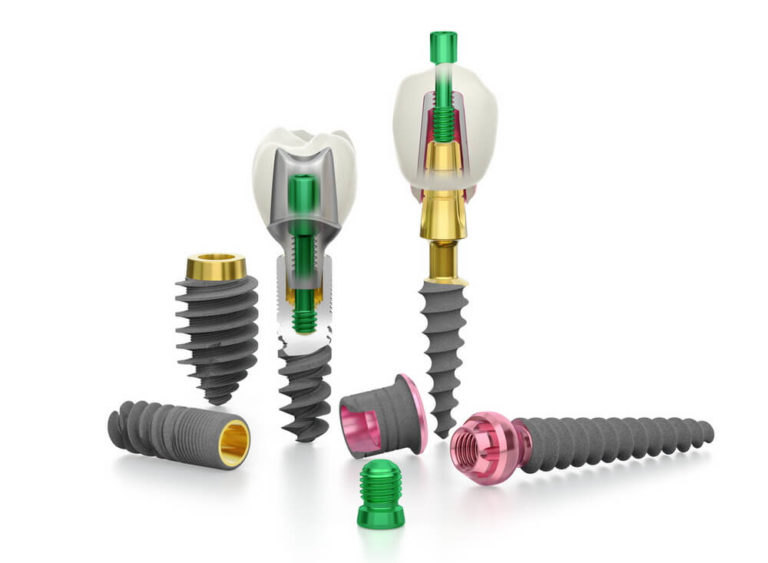 The Comprehensive Guide on Two-Piece, Compressive Screw, and Basal Implants